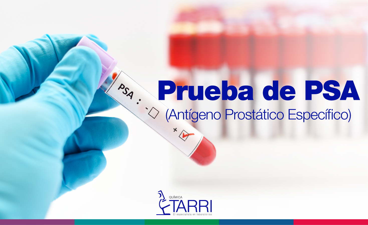 Prueba de PSA (Antígeno Prostático Específico) – Química Tarri