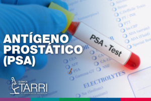 Antígeno Prostático (PSA) – Química Tarri